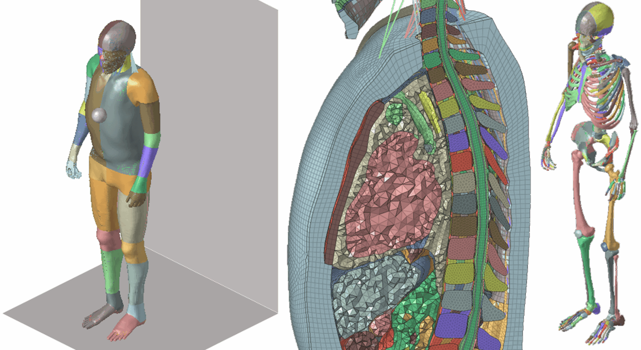 Reference Project: Structural Simulation of a Human Body Model - FiniteNow